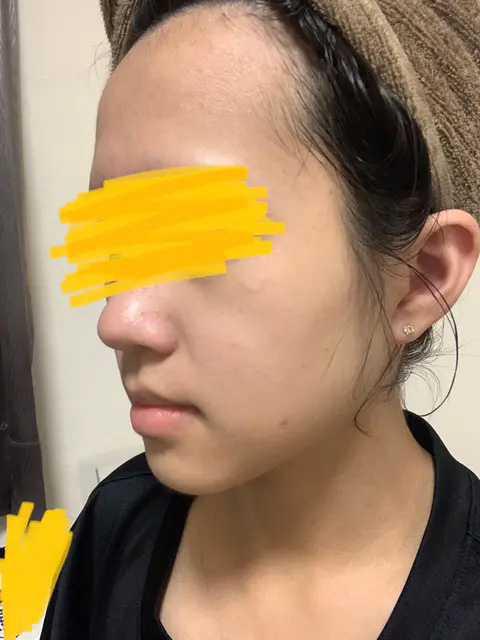 打破你對去角質的印象！【Dcard高分好評】2025臉部去角質推薦 | JS婕洛妮絲